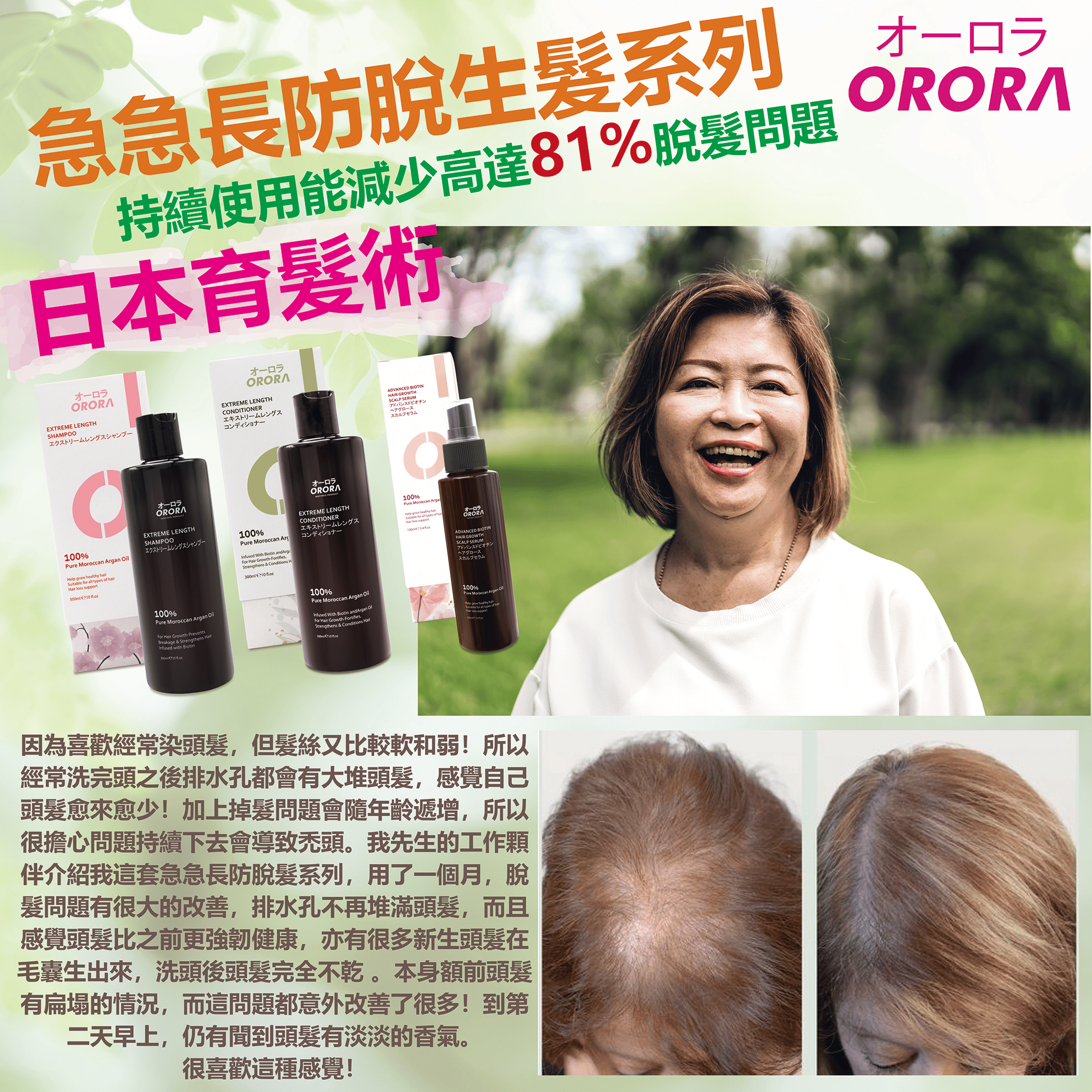 Extreme Length & Anti Hair Loss Shampoo 300ml 批發 | orora